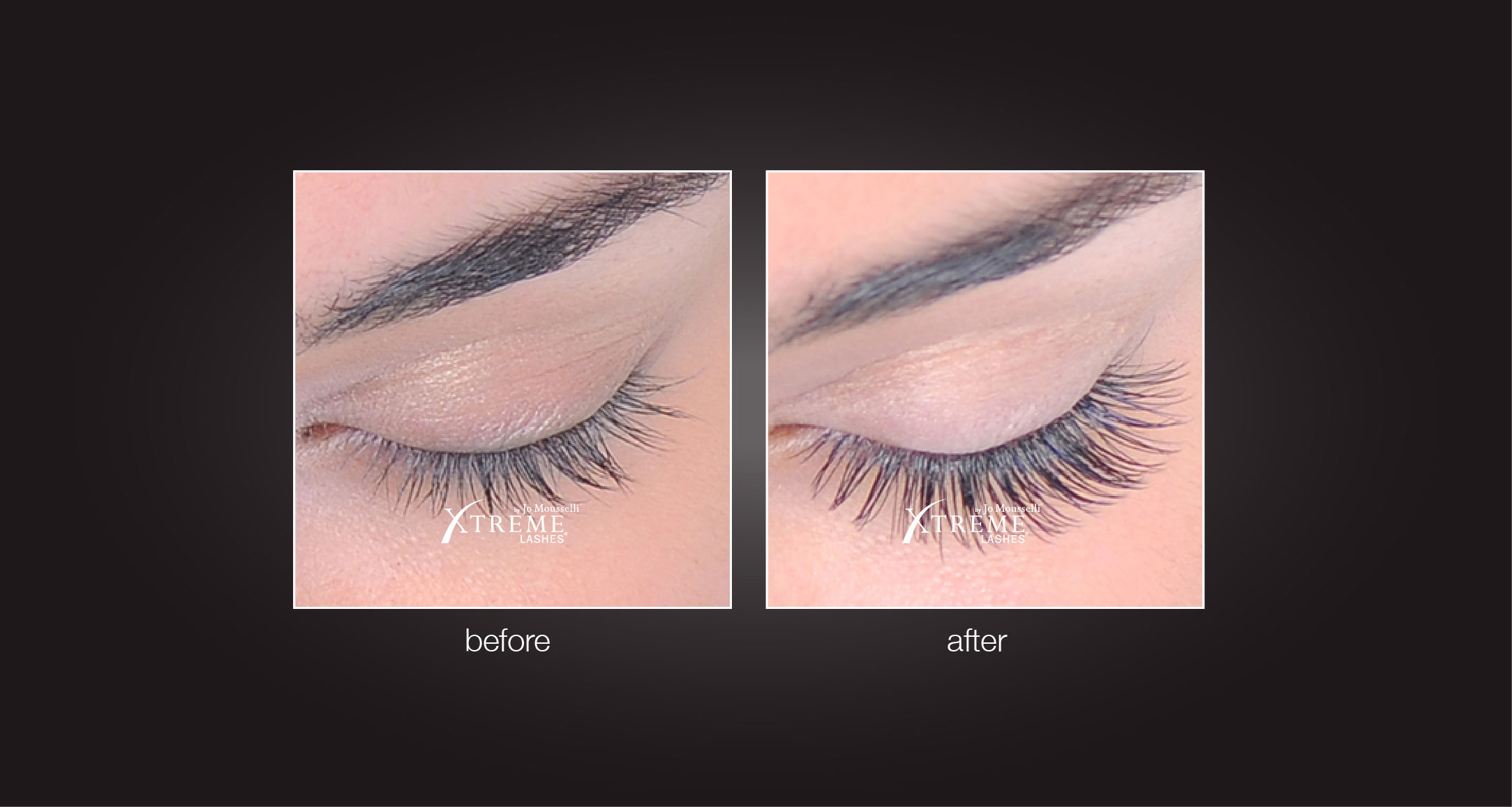 Eyelash Extensions Before and After Photos Eyelash Extensions Before and After Photos